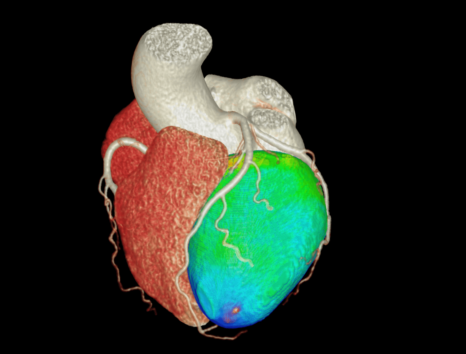 医用画像処理ソフトウェア